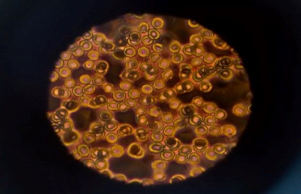 Organoid and Tissues: Cellular Differentiation with Microrobots ...